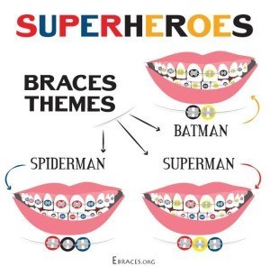 Everything You Need to Know About Rubber Bands for Braces